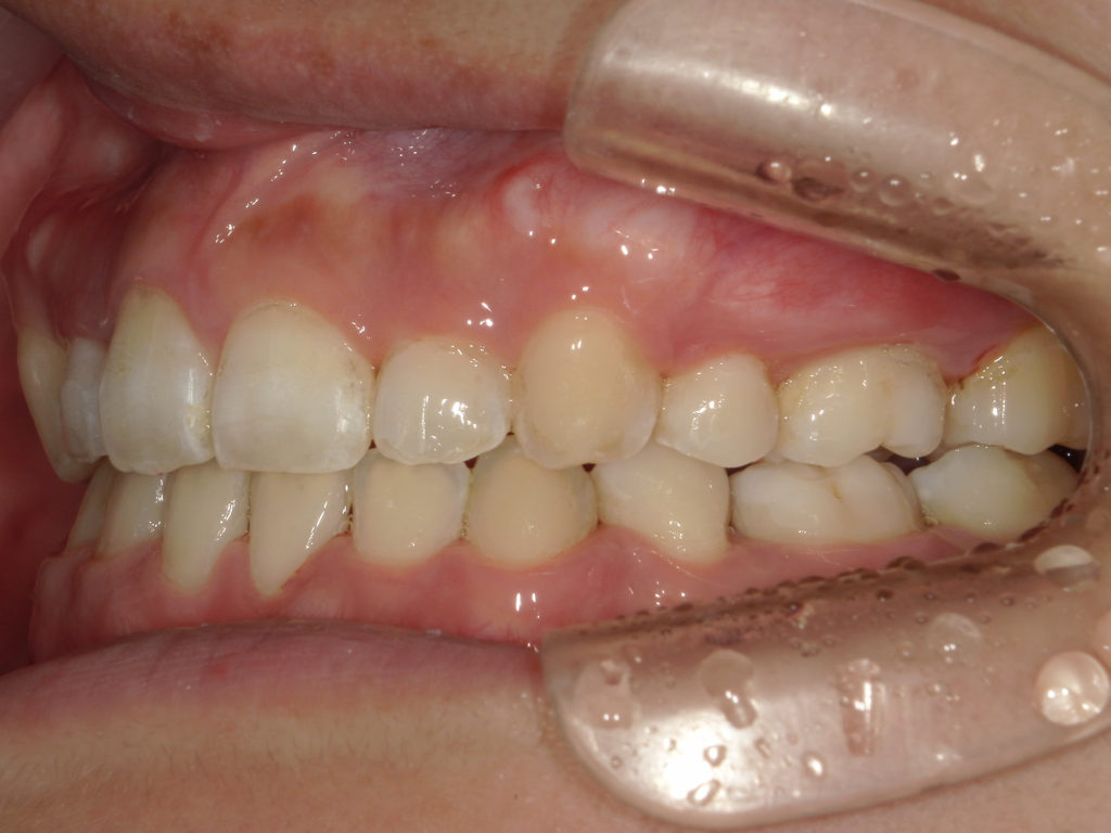 SHOFU DENTAL DIGITAL CAMERA | 浜松市で矯正治療の期間のご相談ならいとう歯科矯正歯科ティースエクセレントクリニックへ