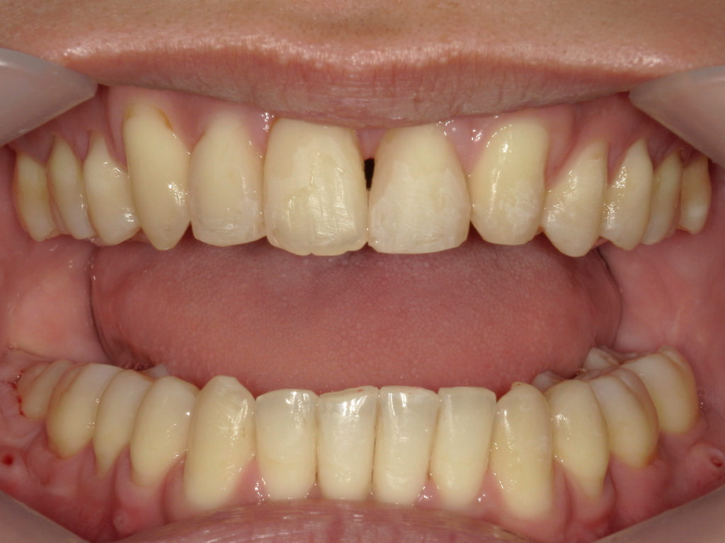 SHOFU DENTAL DIGITAL CAMERA | 浜松市で矯正治療の期間のご相談ならいとう歯科矯正歯科ティースエクセレントクリニックへ